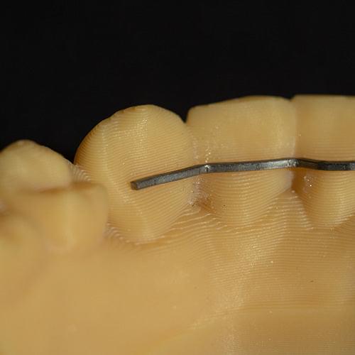 Fil de contention - carré Remanium 0.41 mm (16x16) | 3D TOTEM – 3DTOTEM